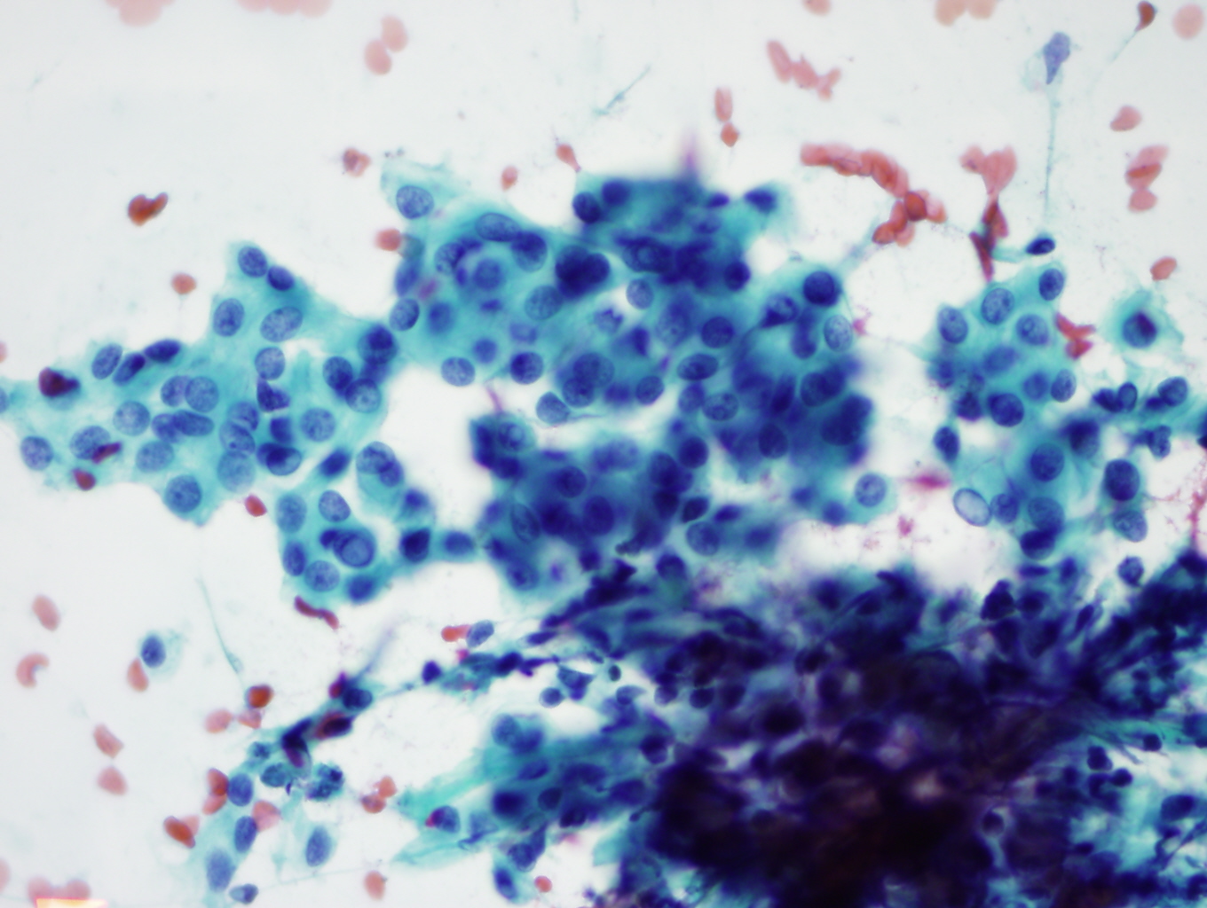 Cytology Stains