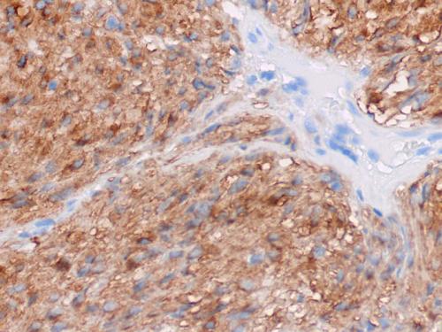 CD117, C-Kit Immnunohistochemistry Control Histology Slides - Newcomer ...