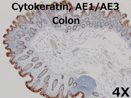 CYTOKERATIN AE1/AE3 Immnunohistochemistry Control Histology Slides ...