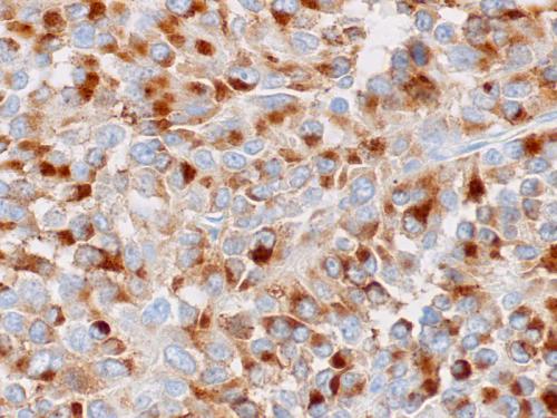 HMB-45 Immnunohistochemistry Control Histology Slides - Newcomer Supply