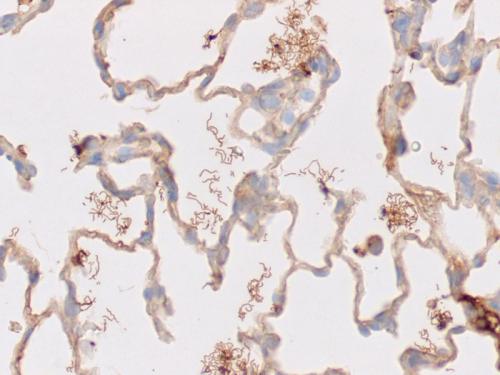 SPIROCHETE Treponema hyodysenteriae Immnunohistochemistry Control ...