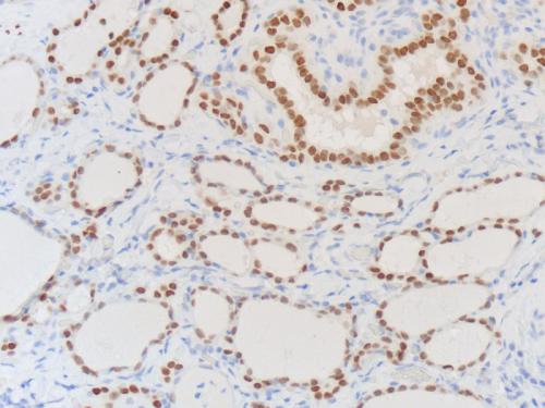 THYROID TRANSCRIPTION FACTOR (TTF-1) Immnunohistochemistry Control ...