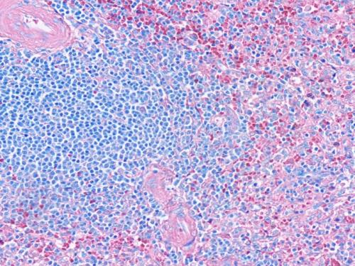 GIEMSA Control Histology Slides - Newcomer Supply