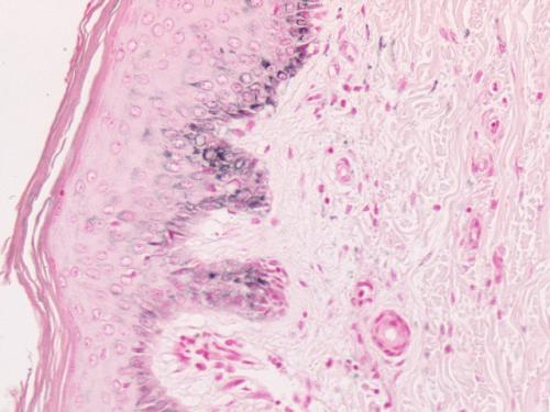 MELANIN Control Histology Slides - Newcomer Supply
