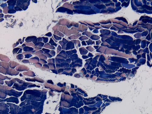 PHOSPHOTUNGSTIC ACID HEMATOXYLIN (PTAH) Control Histology Slides ...