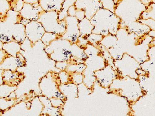 SPIROCHETE, Artificial Control Histology Slides - Newcomer Supply