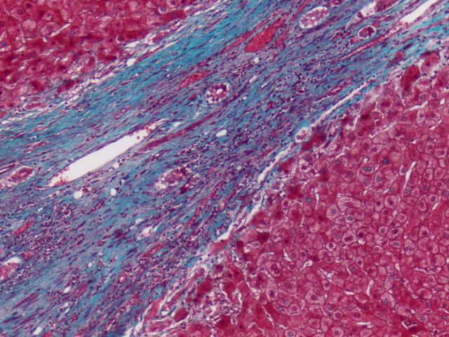 Trichrome, Masson, Fast Green Stain Kit - Newcomer Supply