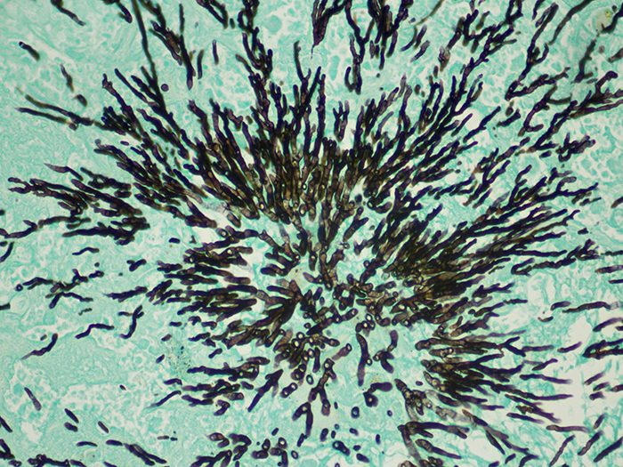 Fungus, GMS, Aspergillus sp. Histology Slides