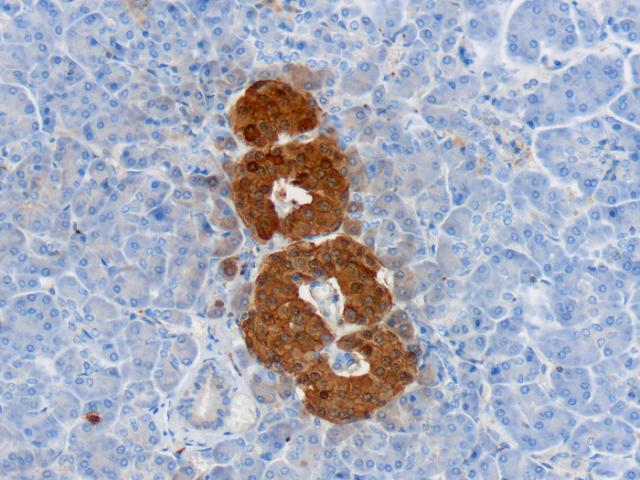NEURON-SPECIFIC ENOLASE (NSE) Immnunohistochemistry Control Histology ...