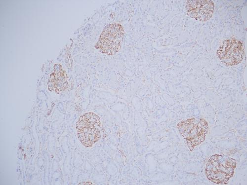 WILMS' TUMOR (WT1) Immnunohistochemistry Control Histology Slides
