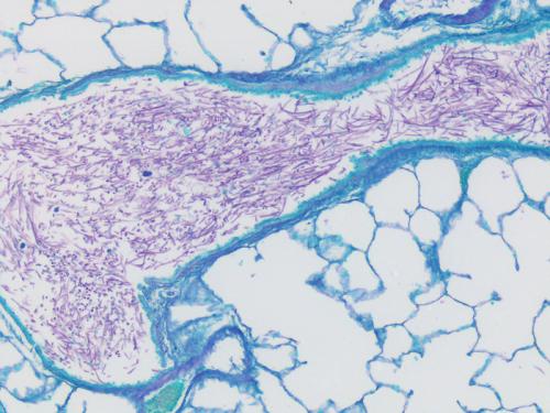 FUNGUS, PAS Aspergillus sp., Artificial Control Histology Slides