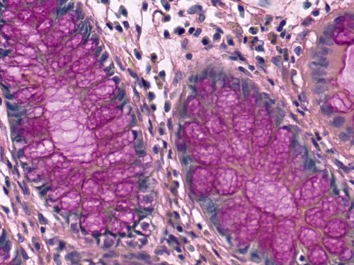 Mucin Mucicarmine Control Histology Slides