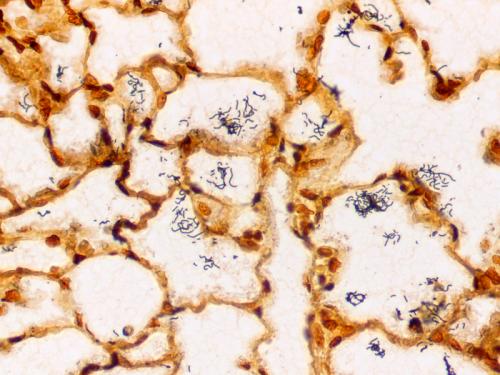 SPIROCHETE, Artificial Control Histology Slides