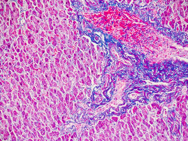 Trichrome, Gomori One-Step, Aniline Blue Stain Kit