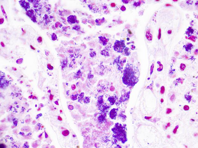 Gram Positive & Gram Negative Bacteria, Animal